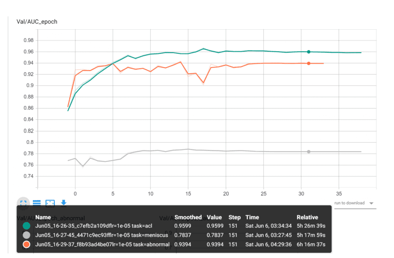 MRNet – The Multi-Task Approach (Python Code)
