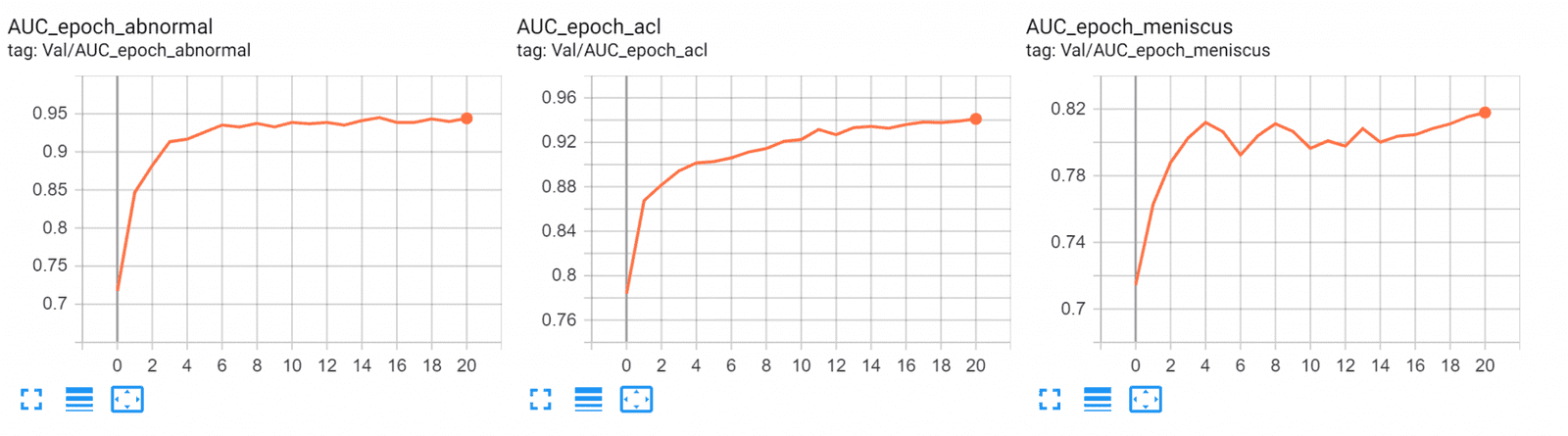 Stanford MRNet Challenge: Classifying Knee MRIs | LearnOpenCV