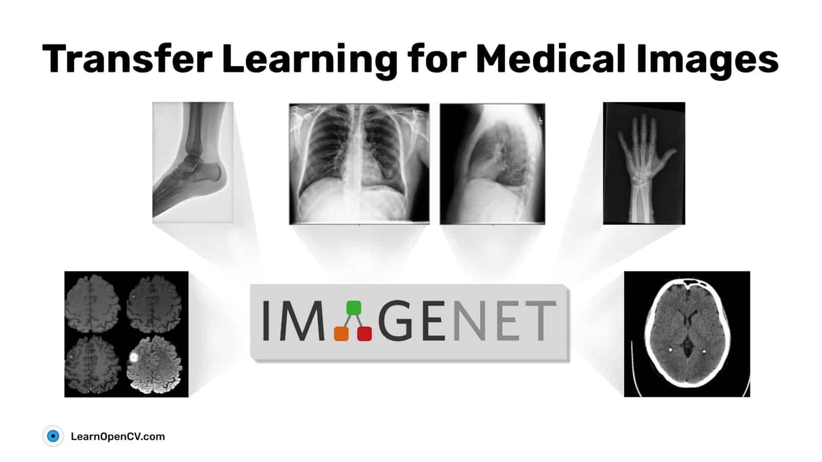 Transfer Learning For Medical Images LearnOpenCV