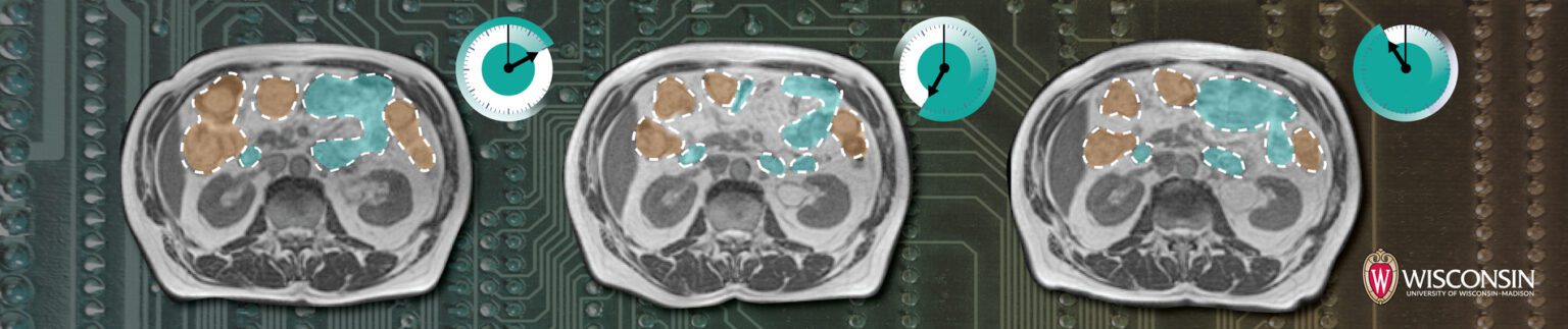 Medical Image Segmentation Using 🤗 HuggingFace & PyTorch Medical Image Segmentation Using 🤗 HuggingFace & PyTorch
