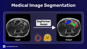 Medical Image Segmentation Using 🤗 HuggingFace & PyTorch