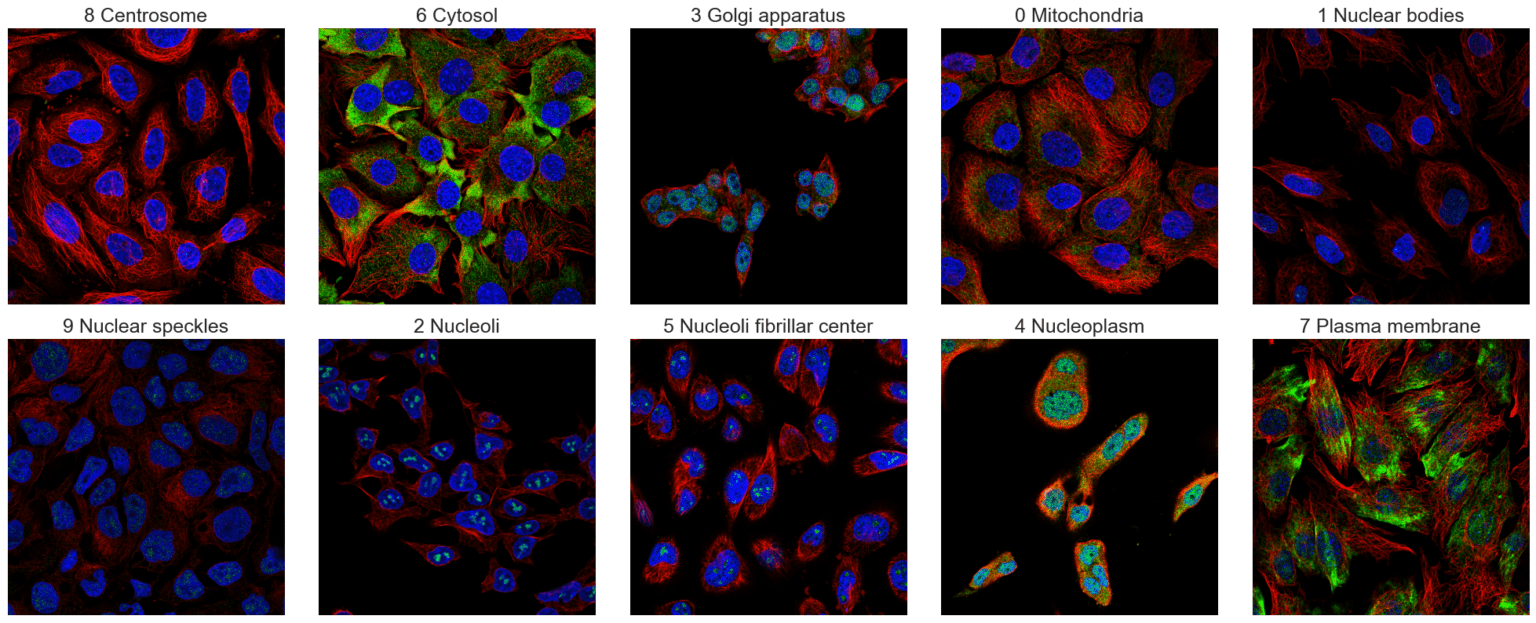 Medical Multi-label Classification With PyTorch & Lightning