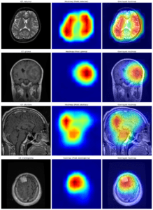 GradCAM: Enhancing Neural Network Interpretability