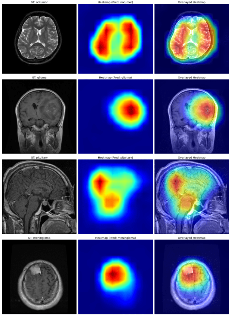 GradCAM: Enhancing Neural Network Interpretability