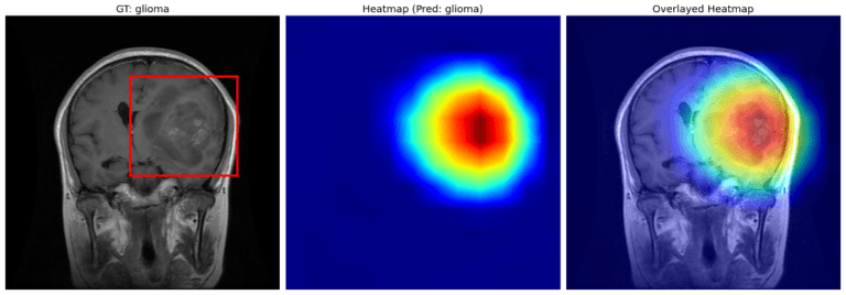 Gradcam Enhancing Neural Network Interpretability