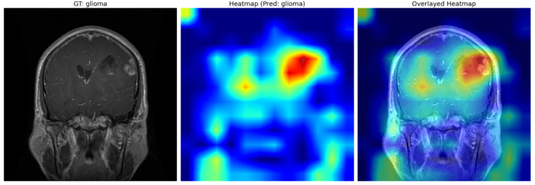 GradCAM: Enhancing Neural Network Interpretability