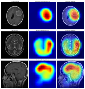GradCAM: Enhancing Neural Network Interpretability