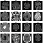 GradCAM: Enhancing Neural Network Interpretability