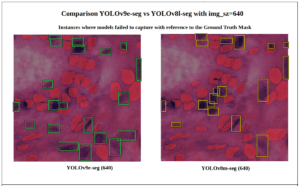 YOLOv9 Instance Segmentation on Medical Dataset