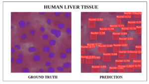 YOLOv9 Instance Segmentation on Medical Dataset
