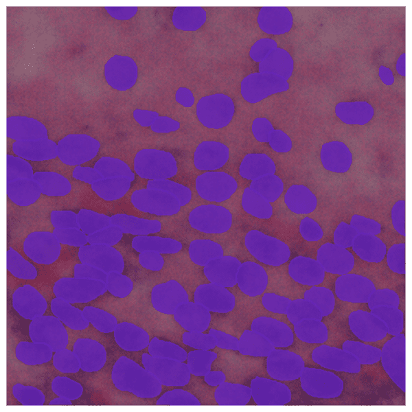 YOLOv9 Instance Segmentation on Medical Dataset